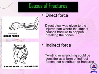 1.3.2 fractures | PPT