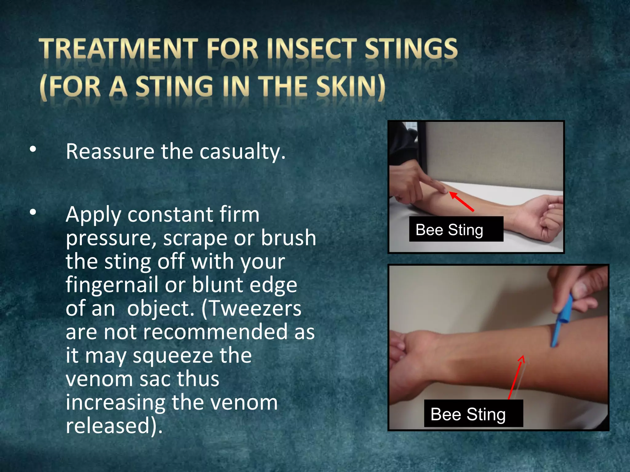 1.3.4 bites & stings | PPT