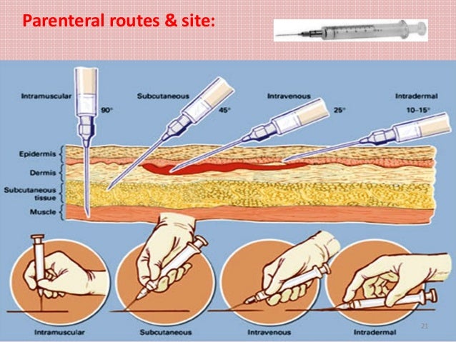 1. introduction, route of administration