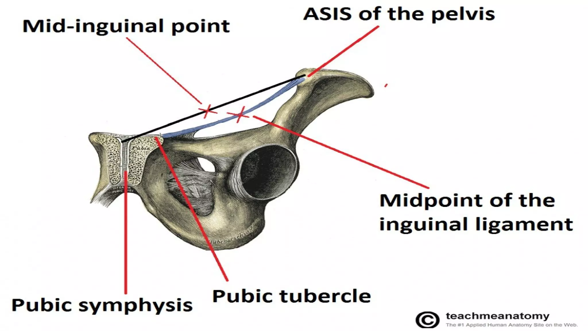 ANATOMY OF INGUINO-SCROTAL REGION | PPT
