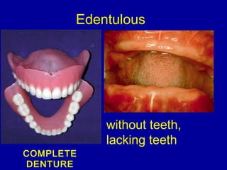 introduction to prosthodontics | PPT