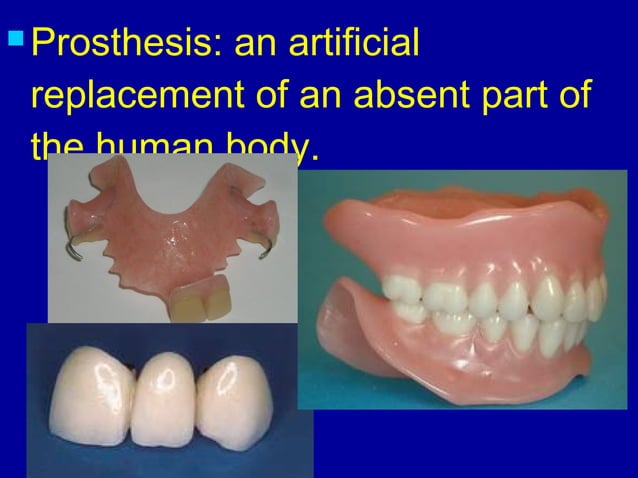introduction to prosthodontics | PPT | Dental Health | Diseases and ...
