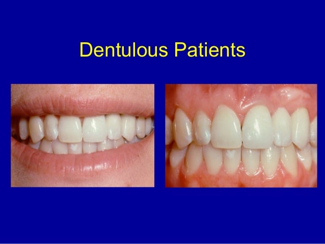 introduction to prosthodontics