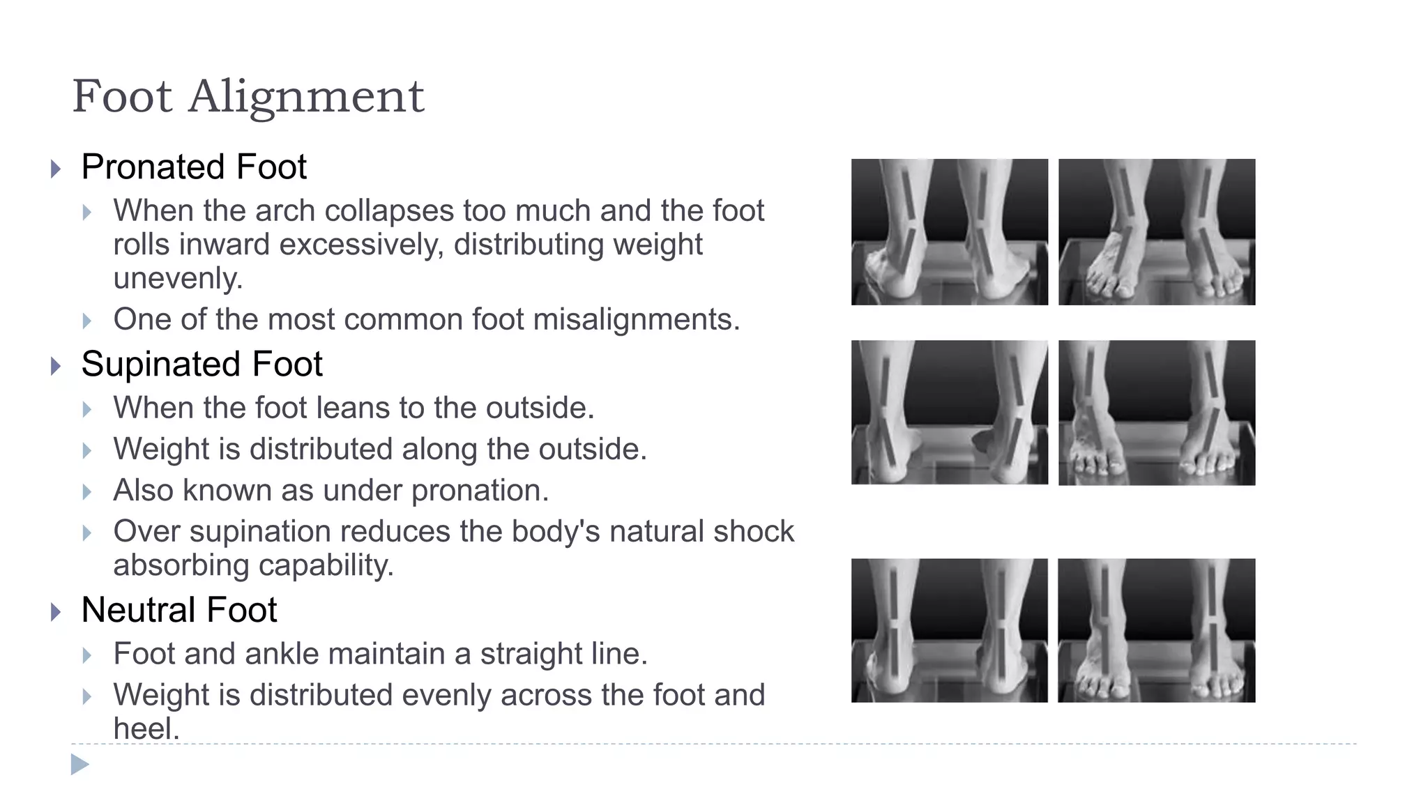 General sports injuries around the ankle foot complex | PPTX