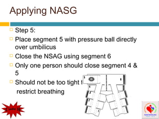 1. transfer of patient in SHOCK THE LIFE WRAP NASG GARMENT | PPT