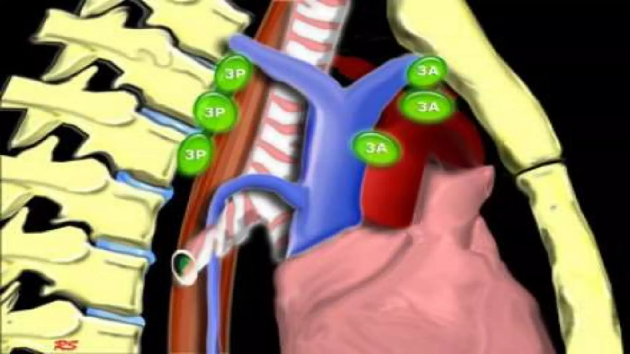 radiological anatomy of thoracic lymph nodes | PPTX