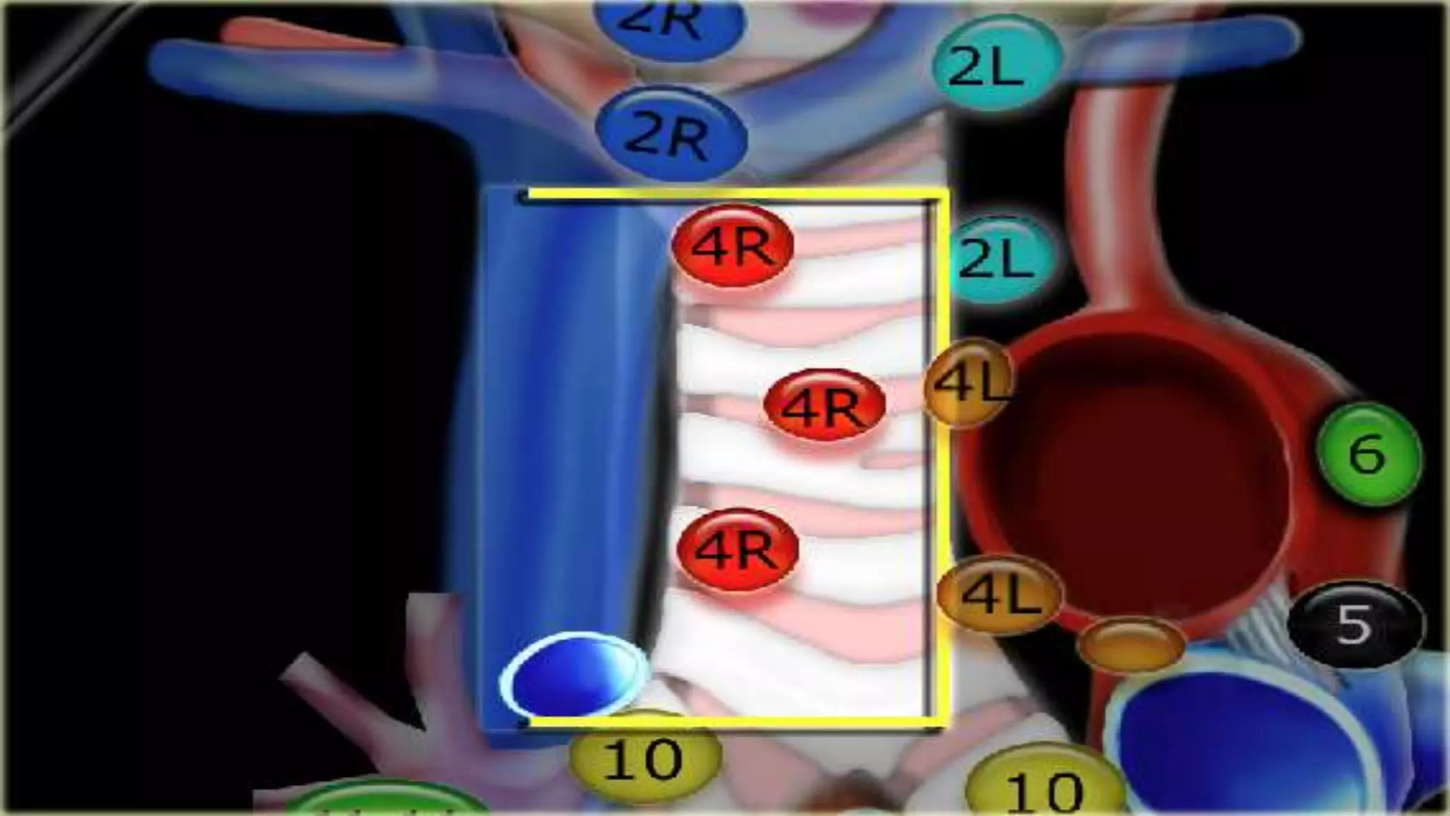 radiological anatomy of thoracic lymph nodes | PPTX