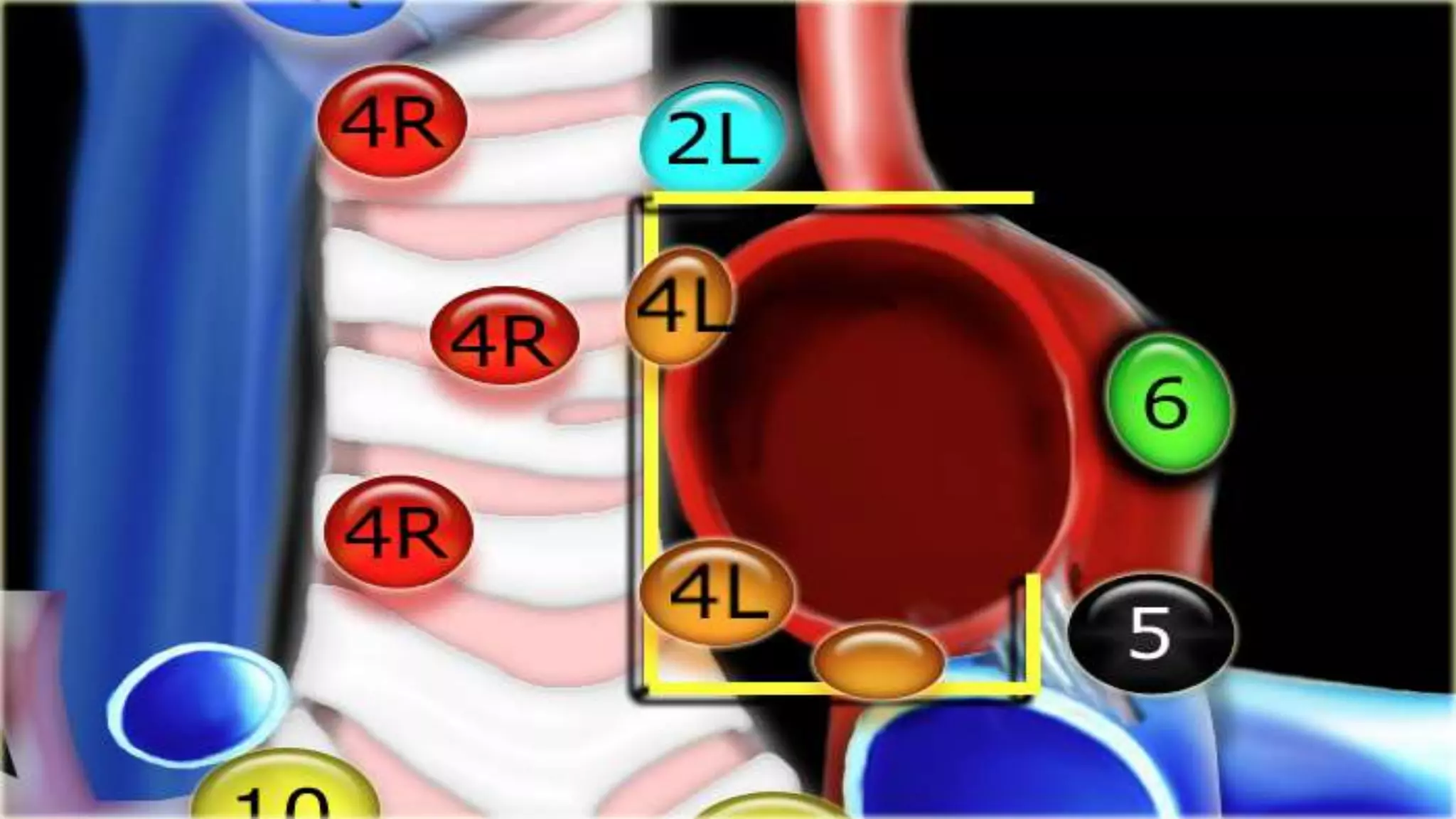 radiological anatomy of thoracic lymph nodes | PPTX