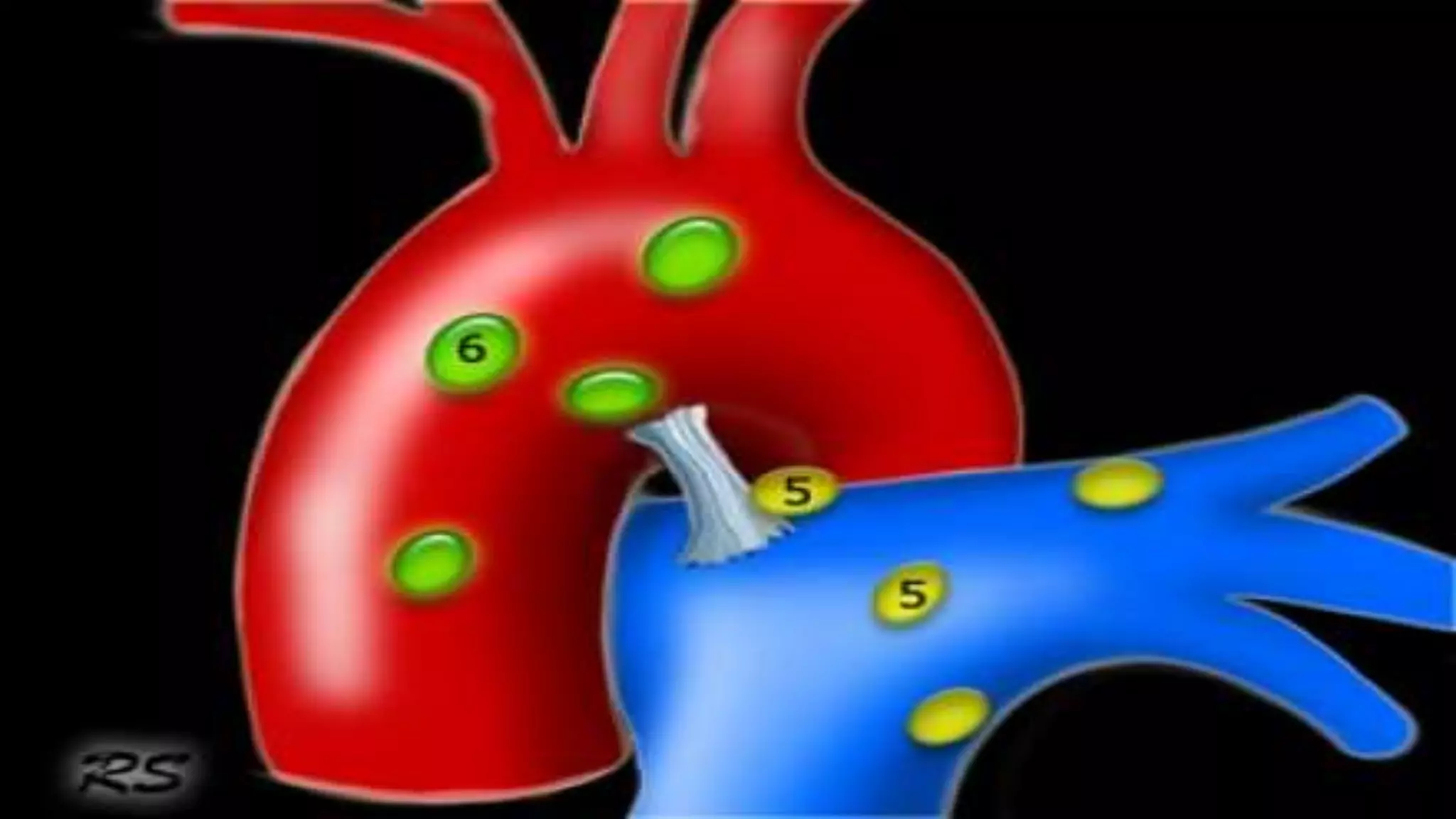 radiological anatomy of thoracic lymph nodes | PPTX