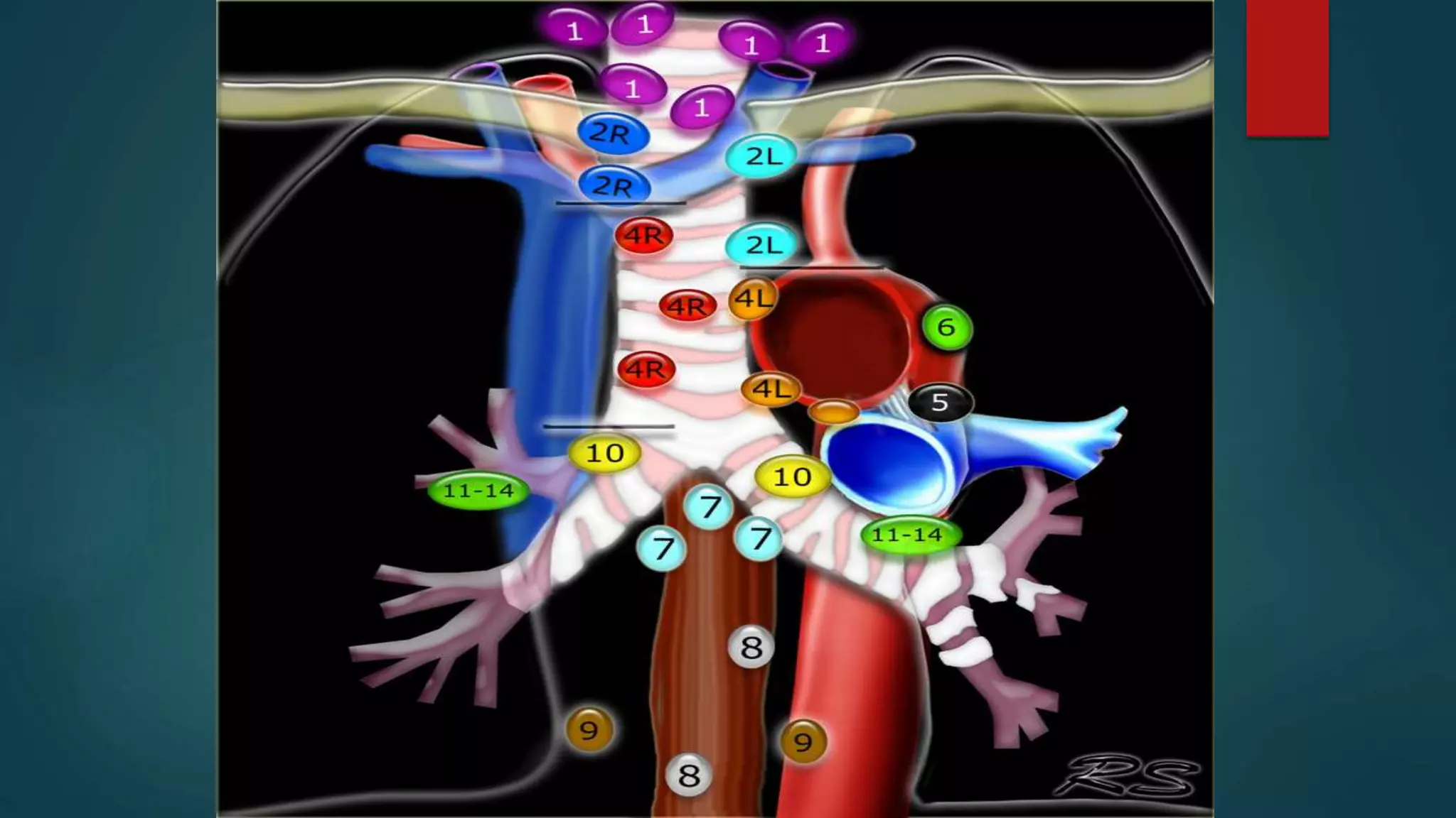 radiological anatomy of thoracic lymph nodes | PPTX
