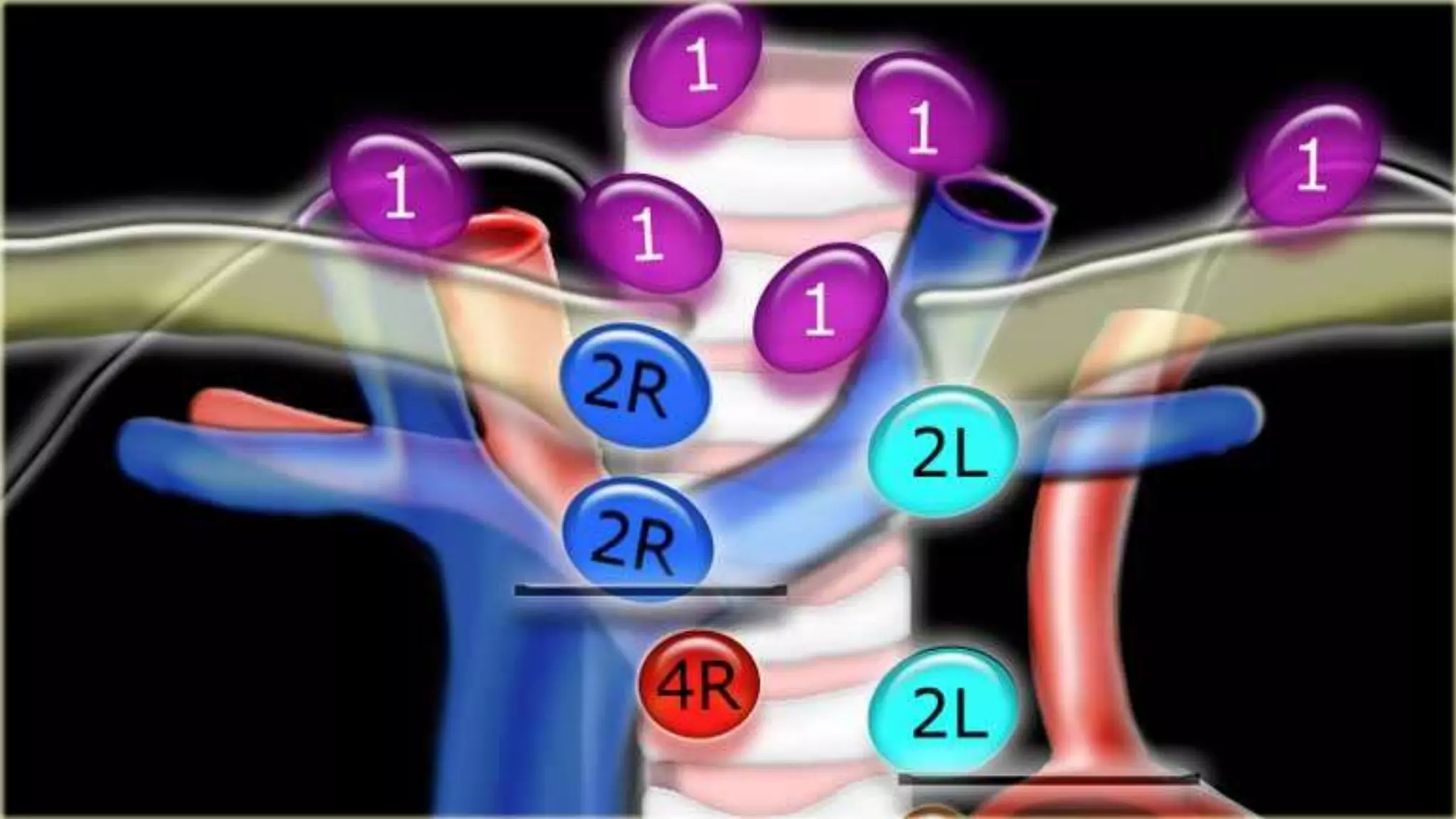 radiological anatomy of thoracic lymph nodes | PPTX