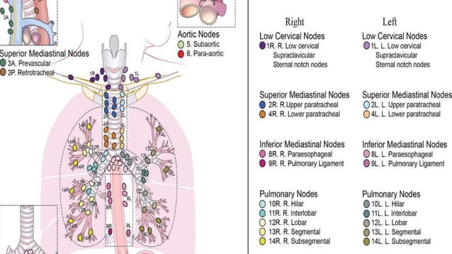 radiological anatomy of thoracic lymph nodes | PPTX | Death, Injury, or ...