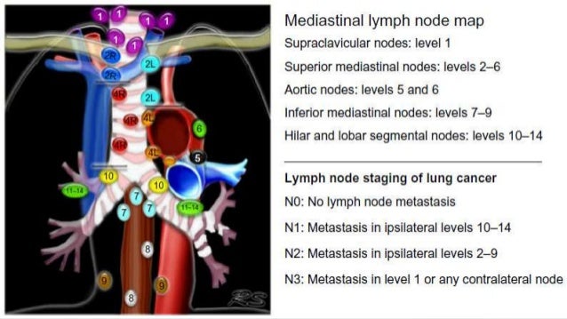 radiological anatomy of thoracic lymph nodes