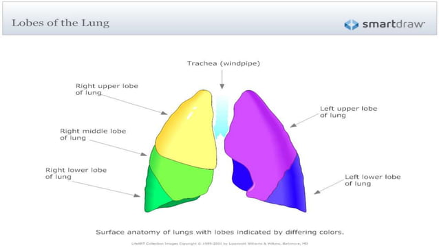 right middle lobe collapse | PPTX | Lung and Respiratory Health ...