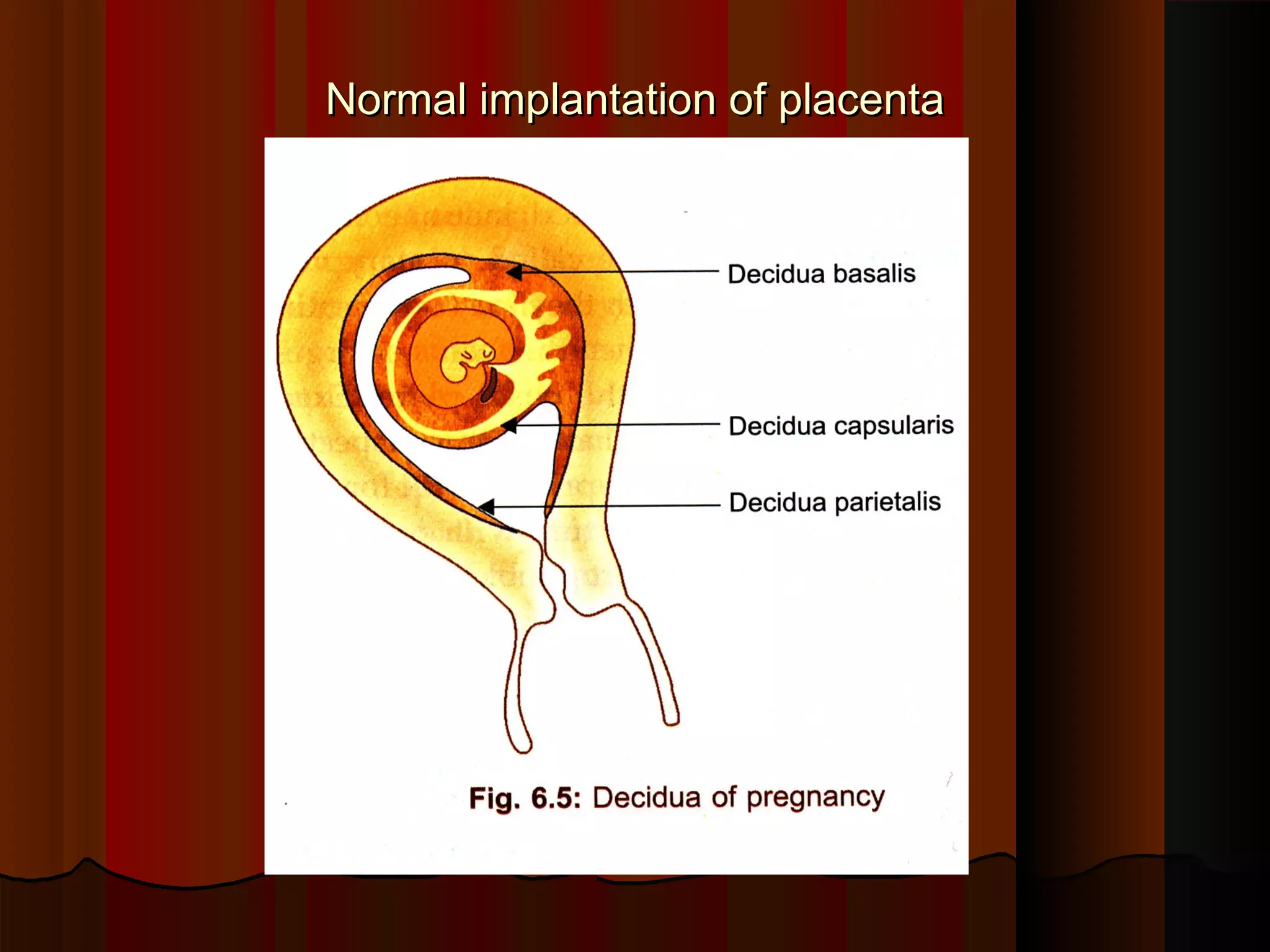 1.abnormal adherence of placenta | PPT