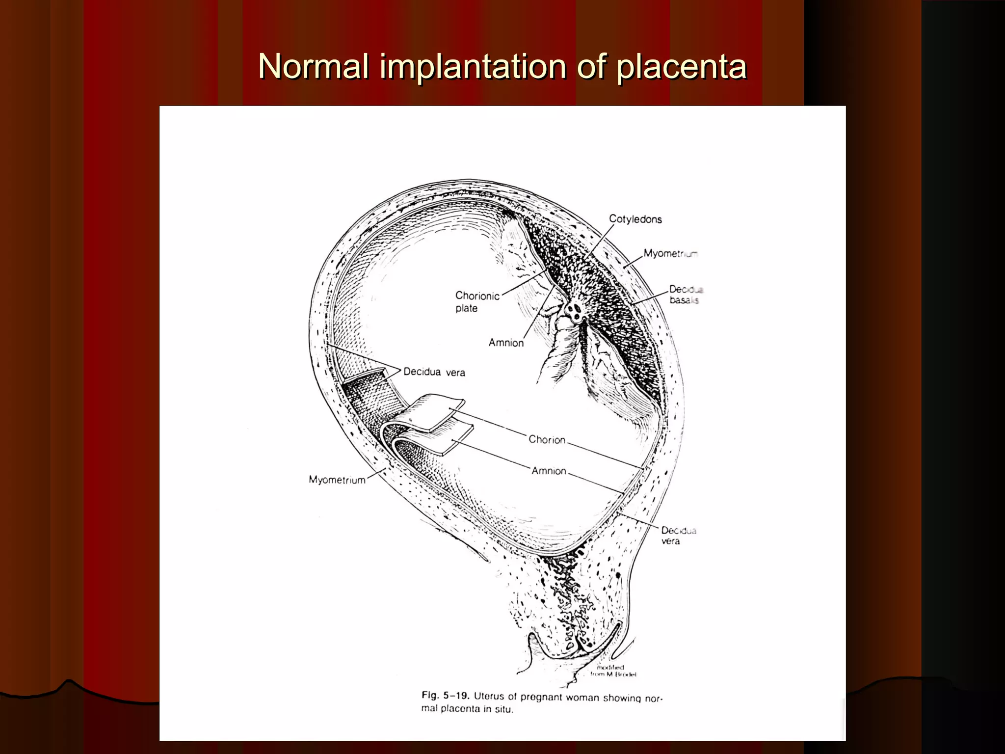 1.abnormal adherence of placenta | PPT