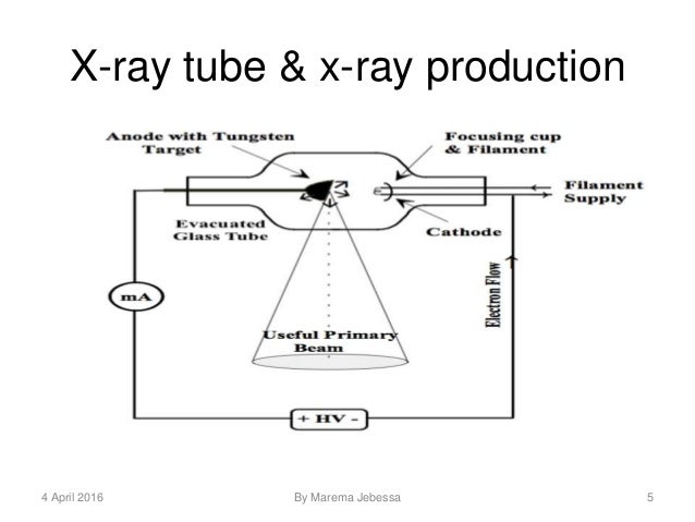 x-ray tube