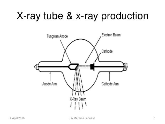 x-ray tube