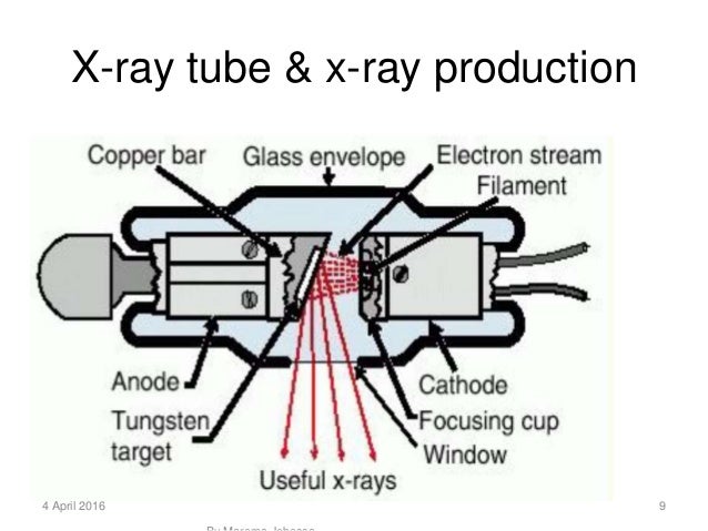 x-ray tube
