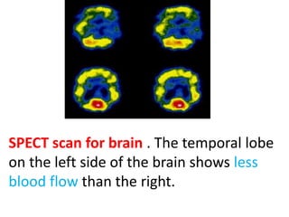 SPECT with clinical application | PPTX
