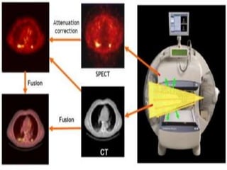 SPECT with clinical application | PPTX