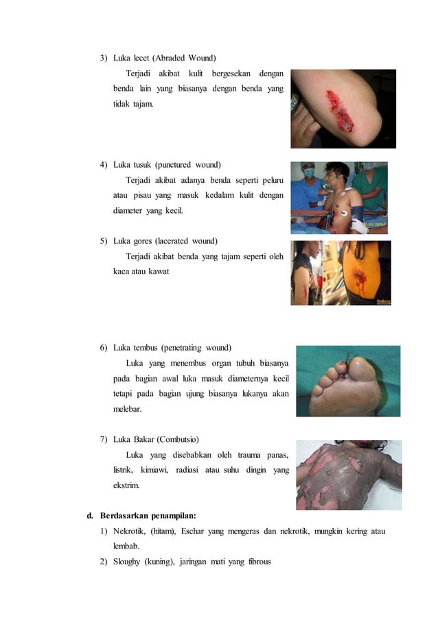 Konsep Luka dan Asuhan Keperawatan pada Luka | DOCX