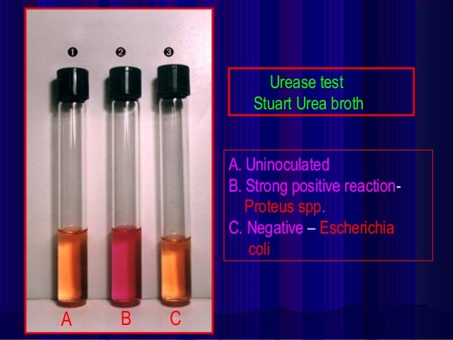 Biochemical tests (1st part)