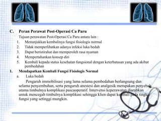 Tindakan Kolaborasi pada Ca Paru | PPTX