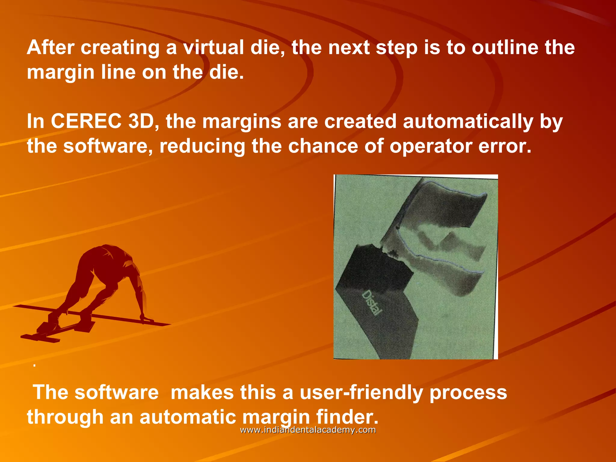 AN OVERVIEW OF THE CEREC 3D CAD/CAM SYSTEM / dental implant courses by ...