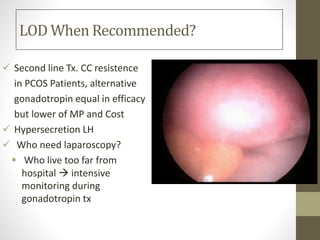 Evidence -based Management of PCOS | PDF