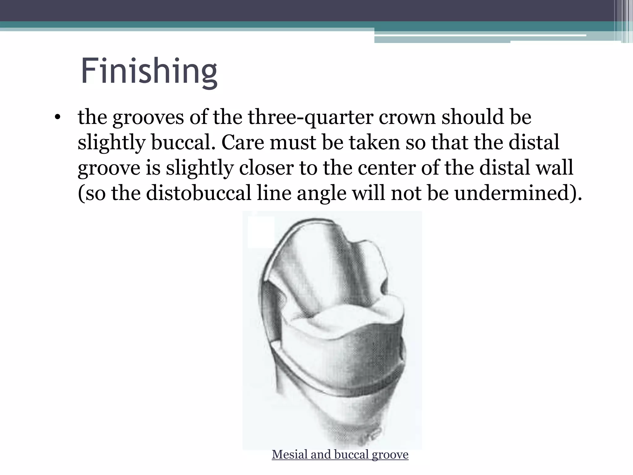 Tooth preparation for partial veneer crwns | PPTX