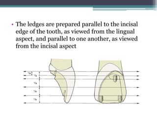 Tooth preparation for partial veneer crwns | PPTX