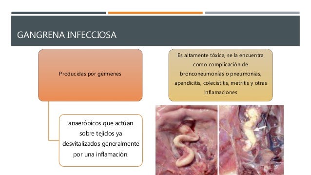 Patologia - Daño celular