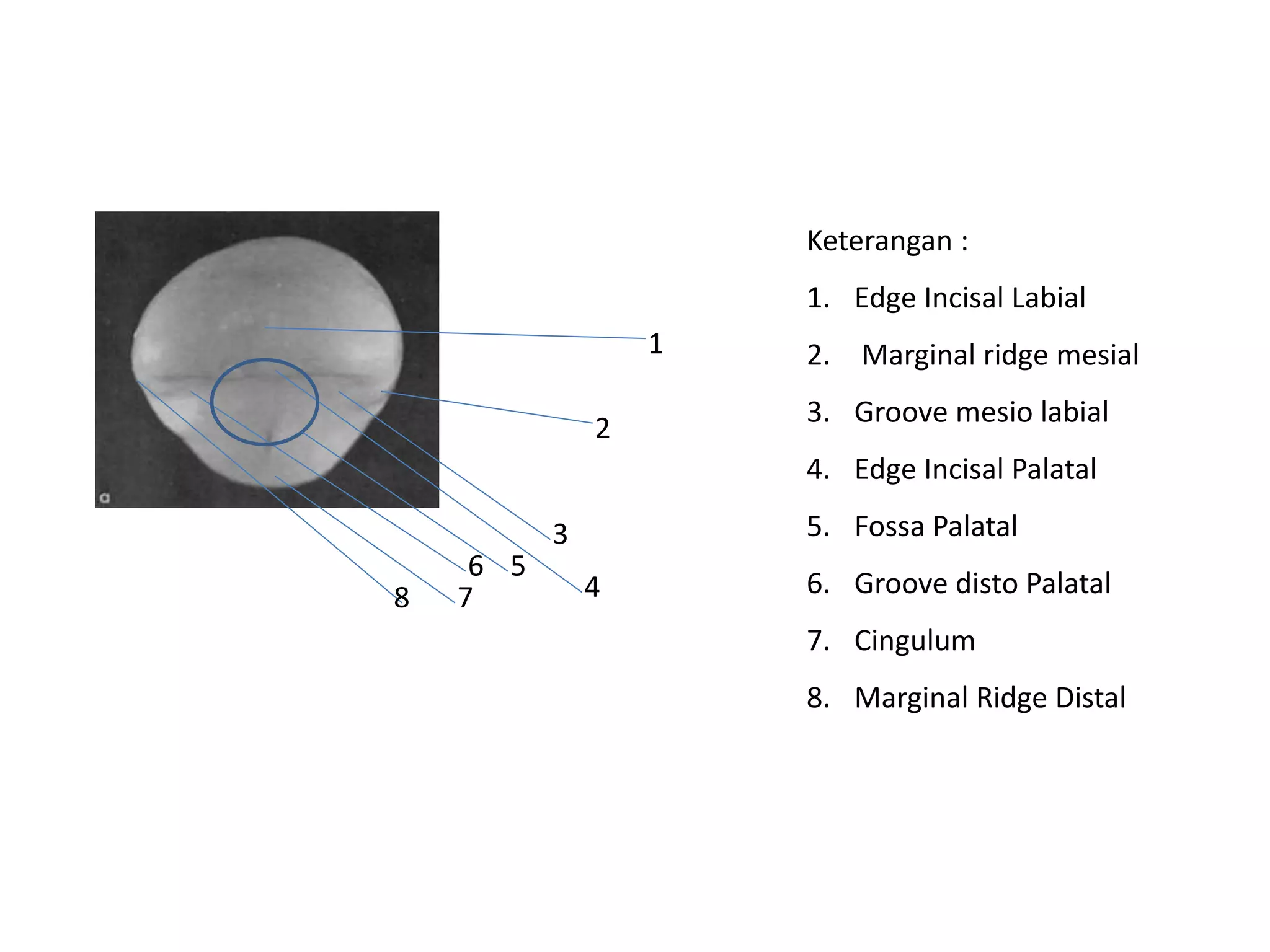 1. anatomi gigi insisivus sentral atas kanan | PPTX