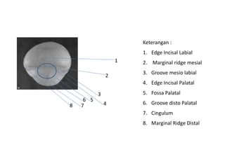 1. anatomi gigi insisivus sentral atas kanan | PPTX
