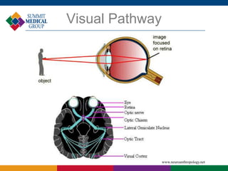 Glaucoma Awareness: Protecting Your Precious Vision | PPTX