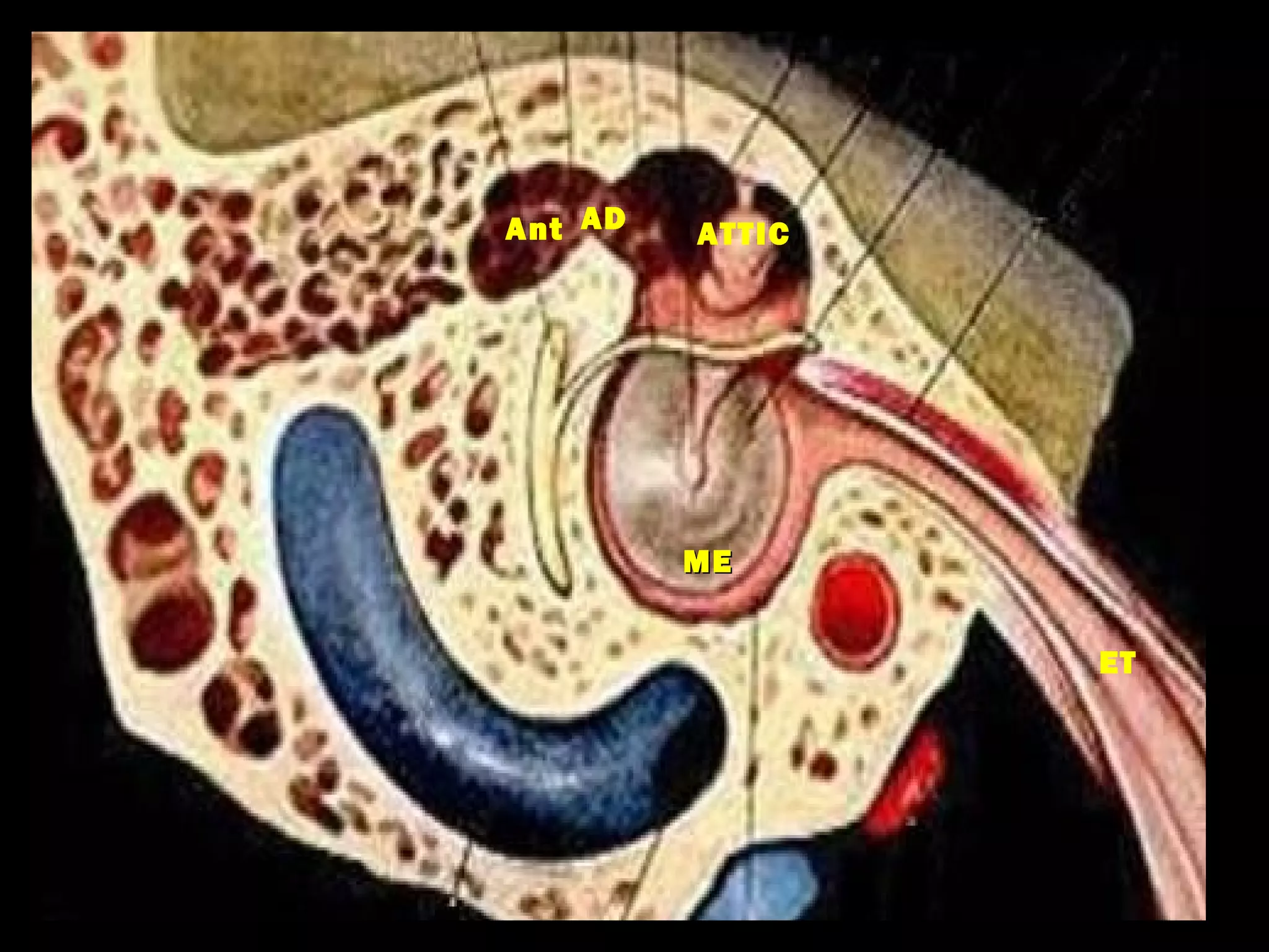 Anatomy of ear and mastoid | PPT