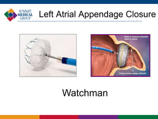 All You Need to Know About Atrial Fibrillation | PPT