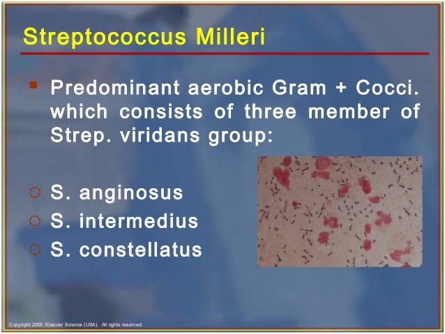 Odontogenic infections