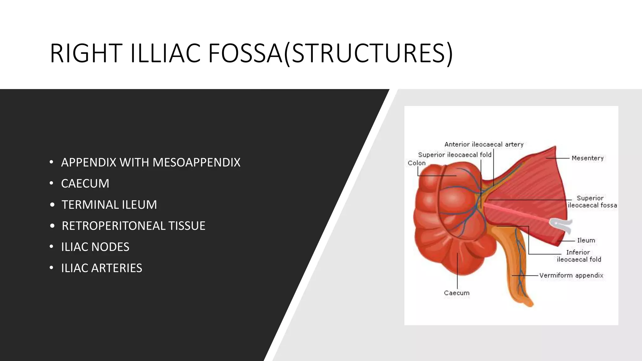 RIGHT ILIAC FOSSA LUMP, WITH SPECIAL REFERENCE TO RIGHT COLONIC CANCER ...