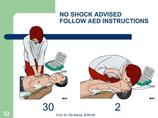 1. bls & als for adults | PPT