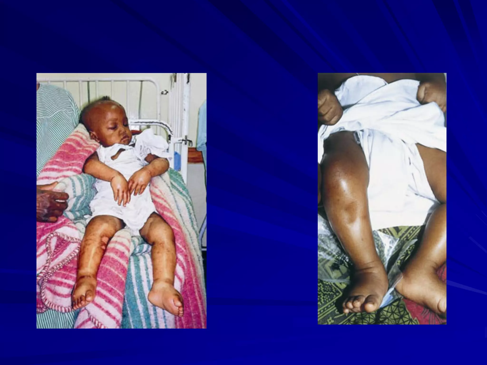 SUY DINH DƯỠNG | PDF