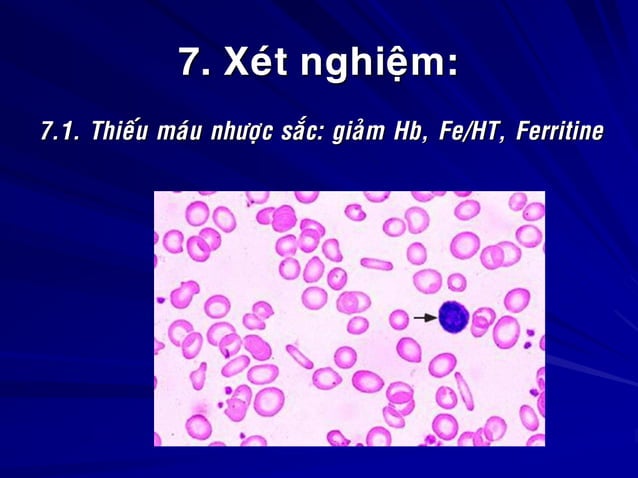 SUY DINH DƯỠNG | PDF