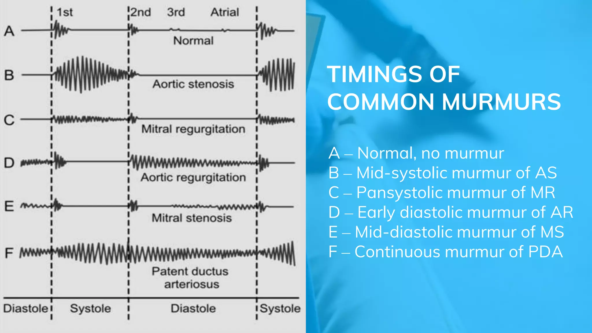 Cardiology 1.6. Heart Sounds and Murmurs - by Dr. Farjad Ikram | PPTX