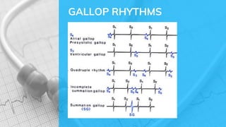 Cardiology 1.6. Heart Sounds and Murmurs - by Dr. Farjad Ikram | PPT