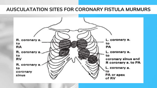 Cardiology 1.6. Heart Sounds and Murmurs - by Dr. Farjad Ikram | PPT