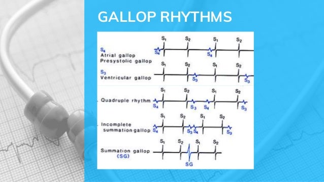 Cardiology 1.6. Heart Sounds and Murmurs - by Dr. Farjad Ikram