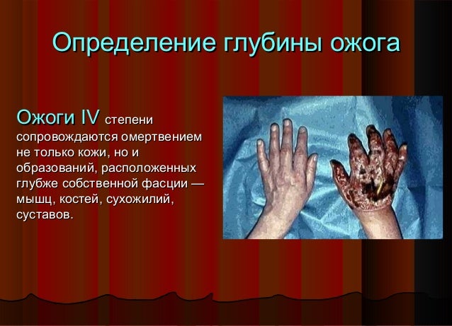 Огнестрельные ранения