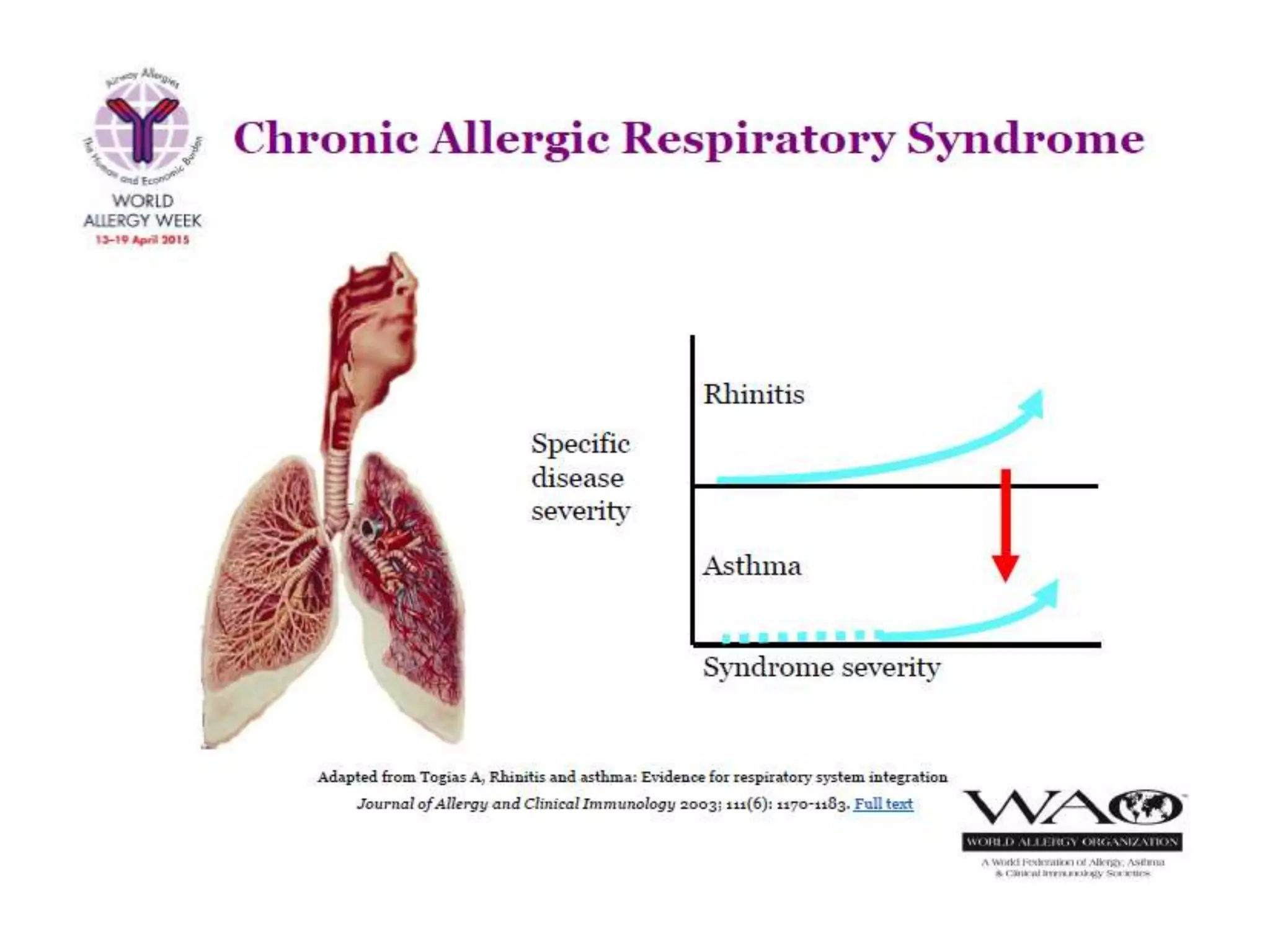Insights in Asthma Rhinitis link | PPTX