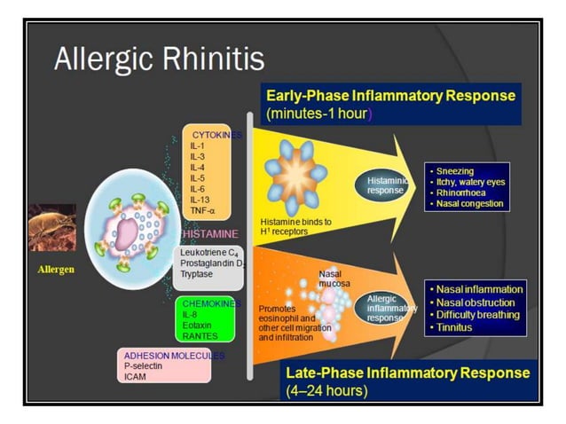 Insights in Asthma Rhinitis link | PPT